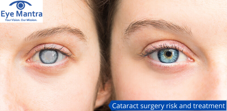 Cataract Surgery Risk And Treatment | Cataract Complications