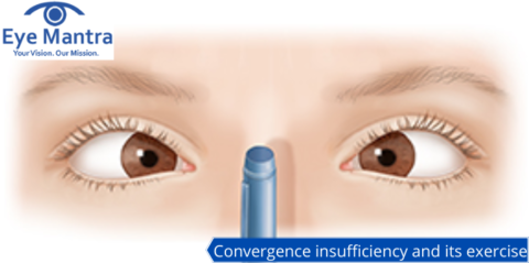 Convergence Insufficiency(CI) Exercises | Causes And Symptoms of CI