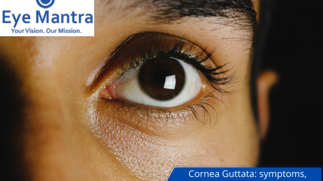 Corneal Guttata
