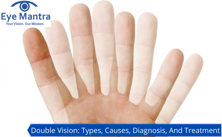 Double Vision (Diplopia): Causes, Treatment, And Eye Exercises