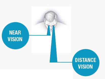 Best Lens Options For Cataract Surgery in 2024- EyeMantra
