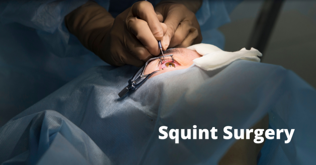 Squint Surgery Cost In Delhi- EyeMantra