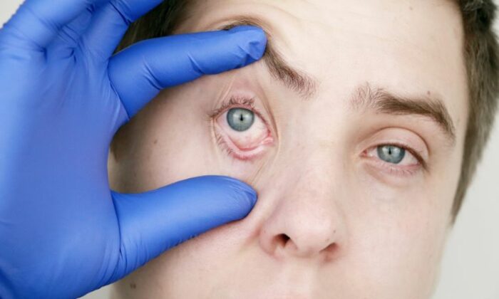 Flap vs Flapless LASIK: Which Technique Suits You Best?
