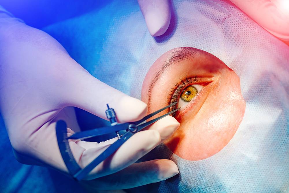 Clear Neo LASIK vs PRK: Choosing the Best Eye Surgery in 2026